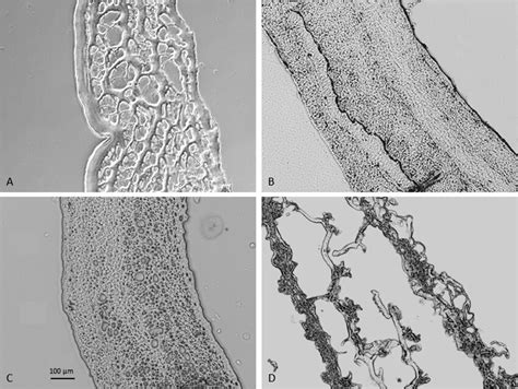 Phase Contrast Microscopy Of Sections Of Fibrin Tubes Before Download Scientific Diagram