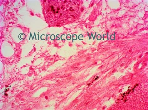 Microscope World Blog Optic Nerve Under The Microscope