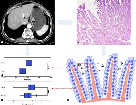 Illustration Of The Ct Texture Parameters And Histopathologic Features Download Scientific