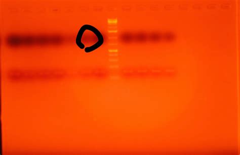 Solved What Is The Expected Bp Value For Amplification Of