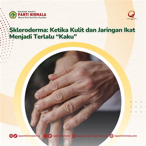 Skleroderma Ketika Kulit Dan Jaringan Ikat Menjadi Terlalu Kaku” Rumah Sakit Panti Nirmala