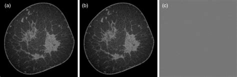 A Truth Image B The Asd Pocs Reconstruction And C Difference Download Scientific