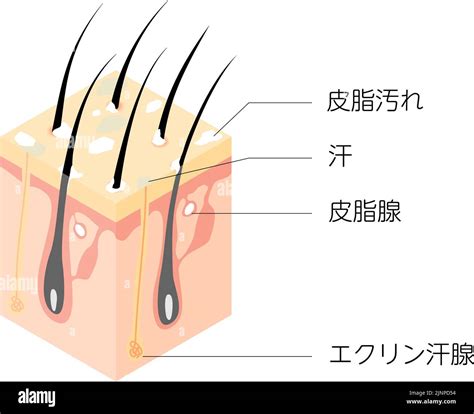 Diagrammatic Illustration Of A Cross Section Of A Dirty Scalp Isometric Translation Dirty