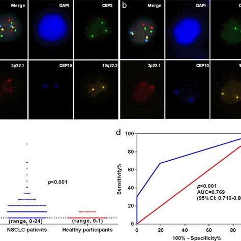 Diagnostic Value Of Cac Test In Patients With Stage I Nsclc A