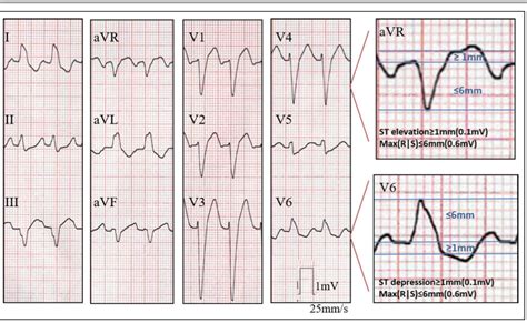 Supra Do Segmento St Retoedu