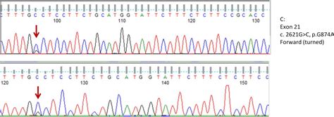 Figure From Presence Of PCR Artifacts In Sanger Sequencing In Formalin Fixed Paraffin Embedded