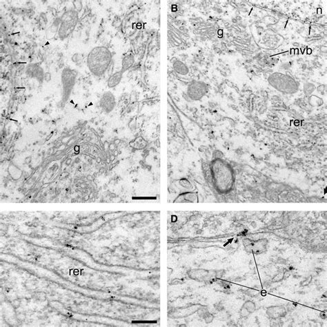 Localization Of Ha Dat Within Dendrites Electron Micrographs From Download Scientific Diagram