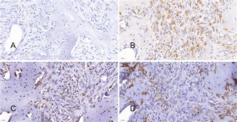 A B The Epithelial Components Ck8 And Ck18 By Download