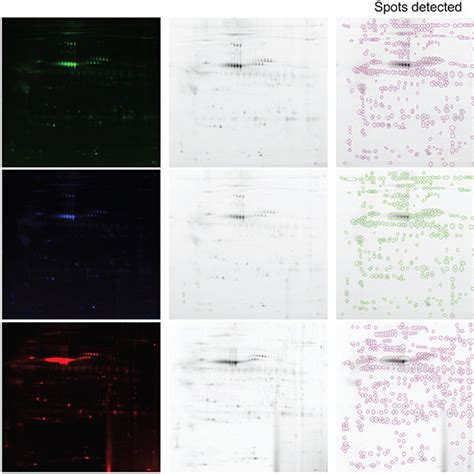 Available 2d Gel Analysis Software And Spot Quantification