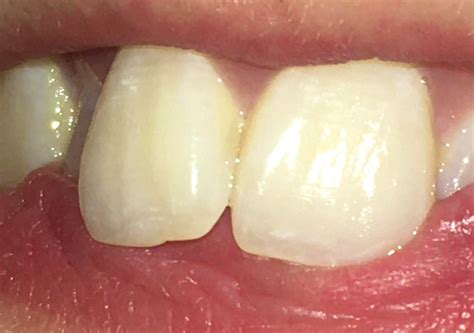 Why Does This Rock Look Like That R Rocks