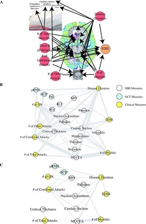 Application Of Graph Theory Based Multimodal Network Analysis On