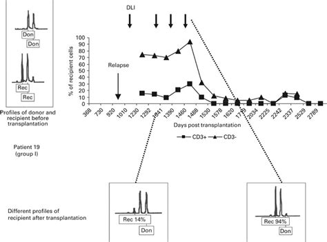 Chimerism Analysis Str Technique For Patient 19 Peak Areas Give The Download Scientific