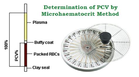 Determination Of Hematocrit Packed Cell Volume Medicoinfo
