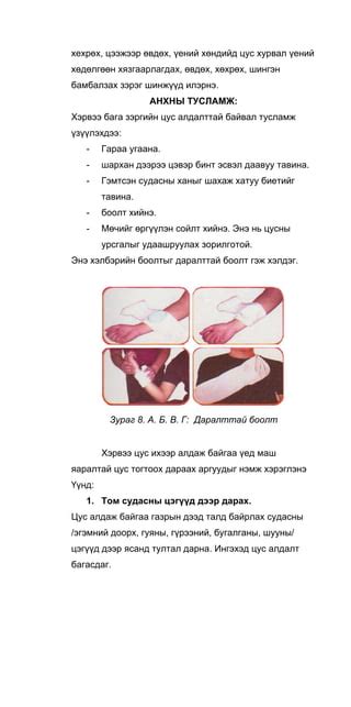 Осол гэмтлийн үед үзүүлэх анхны тусламж Pdf