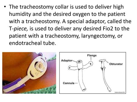 Tracheostomypptx Pptx