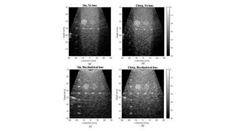 Coded Excitation In 3d Ultrasound Imaging With A Lensed Row Column Array