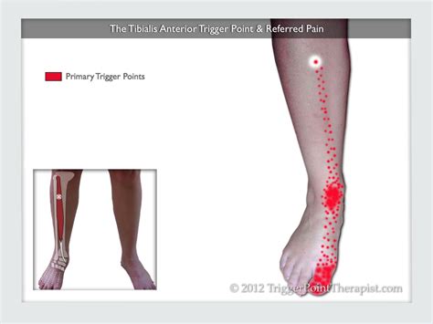 Trigger Point Therapy Blog Triggerpointtherapist Com