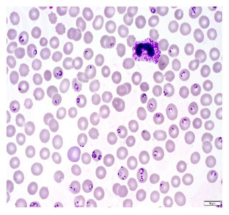 Classification Of Malaria Using Object Detection Models
