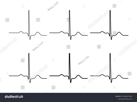 Ventricular Repolarization Cardiac Cycle Ecg Heart Stock Vector
