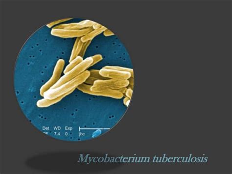 Mycobacterium Tuberculosis Microbiology Pptx
