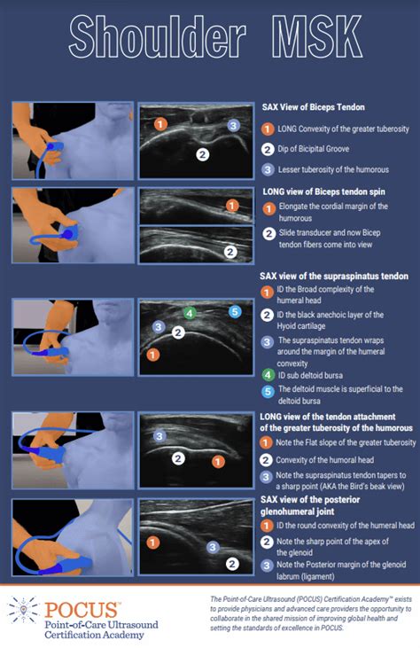 Msk Shoulder Assessment Pocus Resources And Case Studies