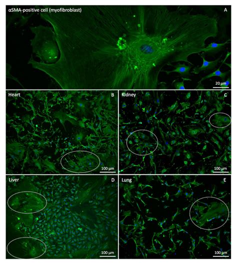 Ultrasonic Augmented Primary Adult Fibroblast Isolation Protocol