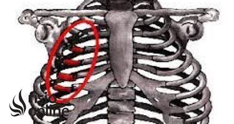 Fractura De Costillas Qué Es Causas Sintomas Y Tratamiento