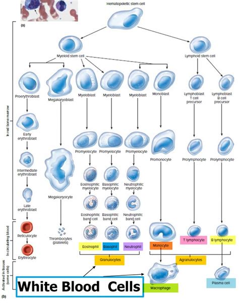 Leukocytosis Definition Causes Symptoms Diagnosis And Leukocytosis