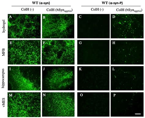 Spreading Of Aggregated α Synuclein In Sagittal Organotypic Mouse Brain