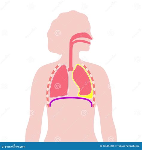 Chylothorax Anatomical Poster Stock Vector Illustration Of Lung Disease 276344255