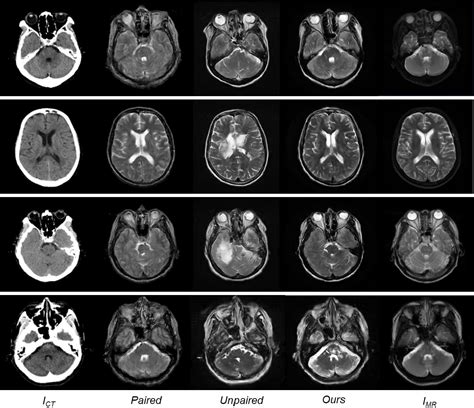 Figure 4 From Deep Ct To Mr Synthesis Using Paired And Unpaired Data