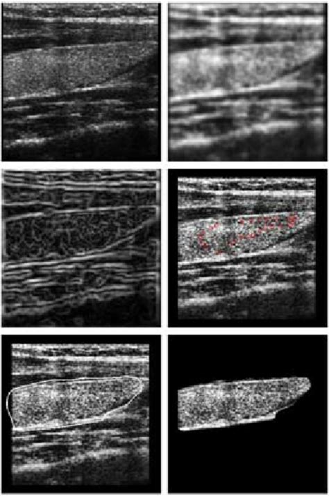 Semi Automatic Segmentation Using Gvf Active Contours From Top Left To Download Scientific