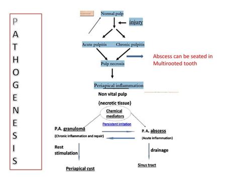 Acute Apical Abscess Dr Anirudh Singh Chauhan Pptx