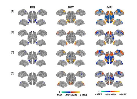 Resting State Functional Connectivity By Fnirs Hbr And Fmri Download