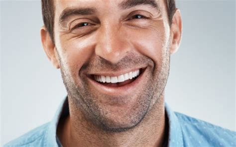 Frenectomy Explained Tongue Tie Lip Tie And Recovery Perth