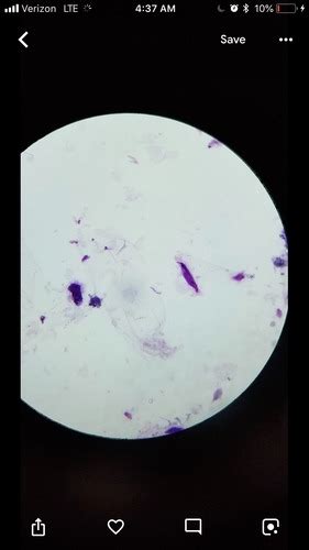 Protist Lab Flashcards Quizlet