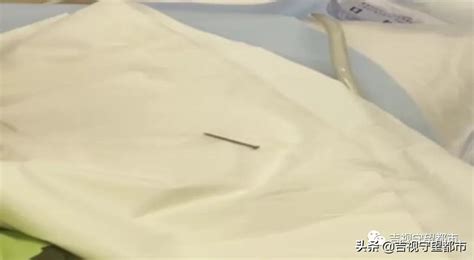 误吞4厘米钢钉，13岁“熊孩子”被紧急送医 标件库