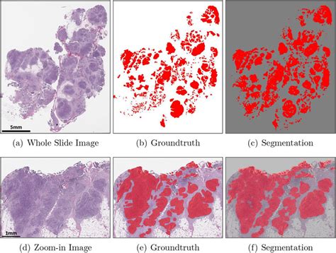 Ovarian Image Its Groundtruth And Its Segmentation A C Show The