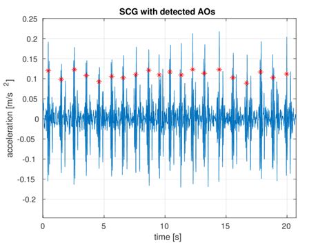 Example Of Detection Results On Scg Signal Fragment Acquired From