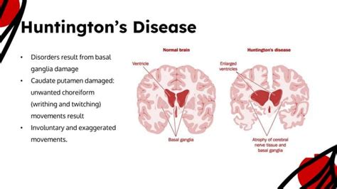 Motor Systems Overview Anatomy And Functions Pptx Brain And Nervous System Disorders