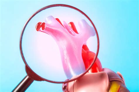 파란색 배경에 돋보기 아래 심장의 염증이 있는 관상 동맥 심장 관상 동맥의 죽상 동맥 경화증의 개념 심장 마비 및 협심증의 위험 클로즈업 0명에 대한 스톡 사진 및 기타