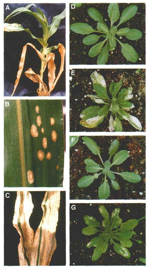 Athetosis Semantic Scholar