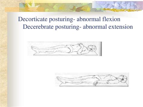 Extension Vs Flexion Posturing At Donald Cambron Blog