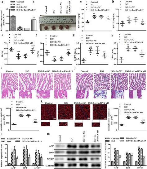 Long Noncoding Rna H19 Suppresses Cardiac Hypertrophy Through The