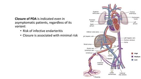 Patent Ductus Arteriosus Pda Echocardiographic Assessment Anatomy Flow And Suitability For