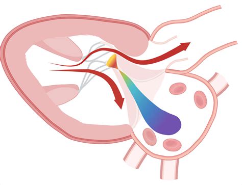 When To Use Vbg Vs Abg Key Guidelines For Diagnosis