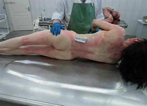 Autopsy Of Babe Woman Xgore