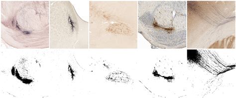 Automatic Detection Of Neuronal Labeling In Histological Image Series