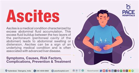 Cessation Definition