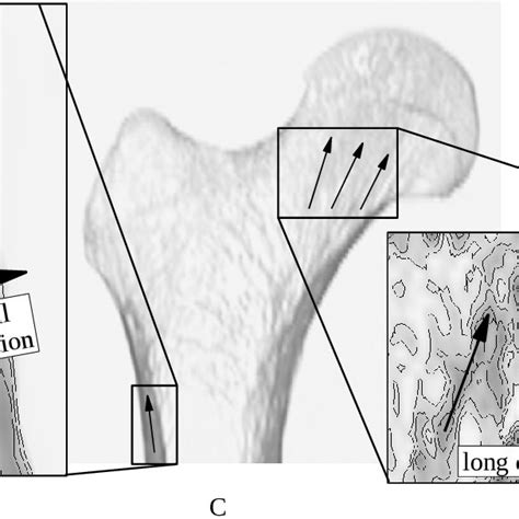 Pdf Finite Element Analysis Of A Bone Implant System With Comparison